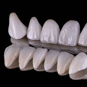 Digital Smile Design (DSD) | UpTown Dental